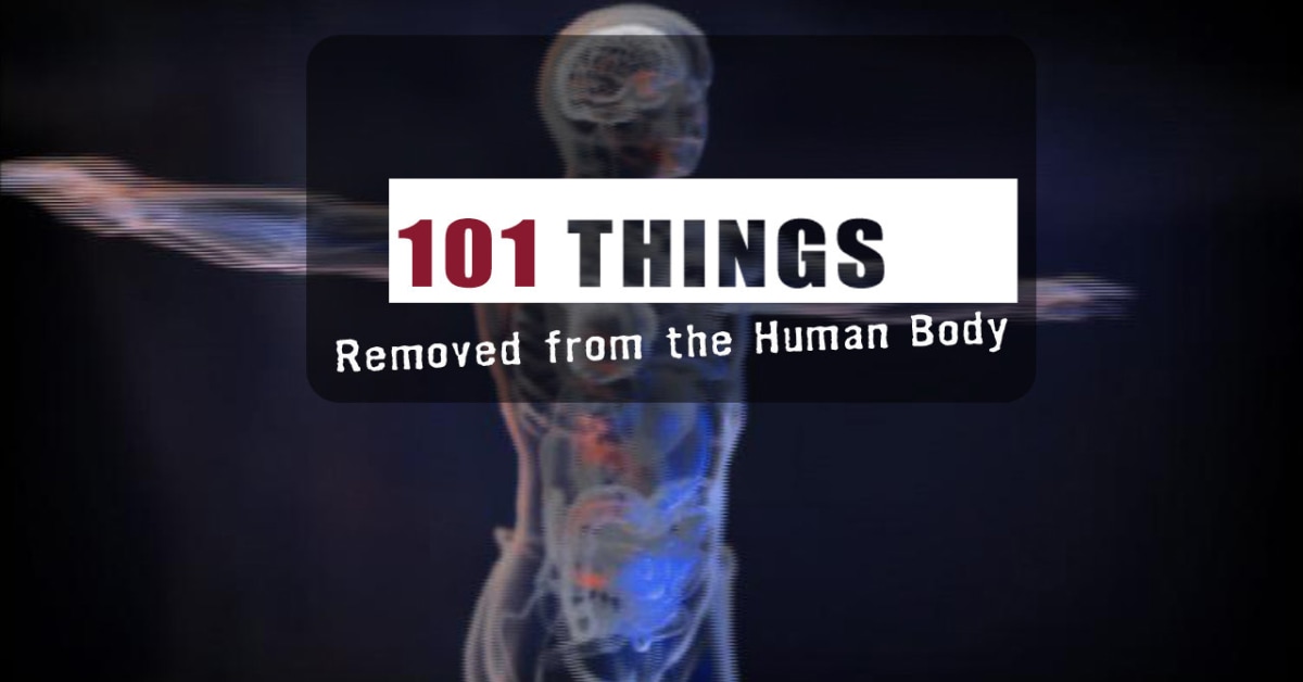 Stream 101 Things Removed From The Human Body Series & Episodes | Watch ...